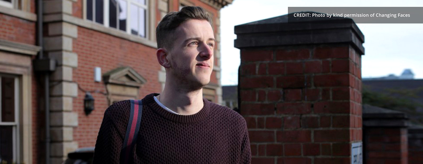 Welcome to Changing Faces | Changing Faces