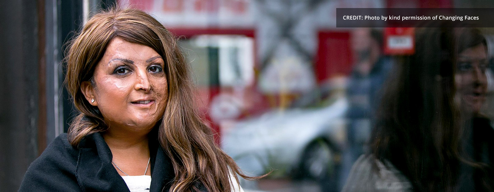 Welcome to Changing Faces | Changing Faces